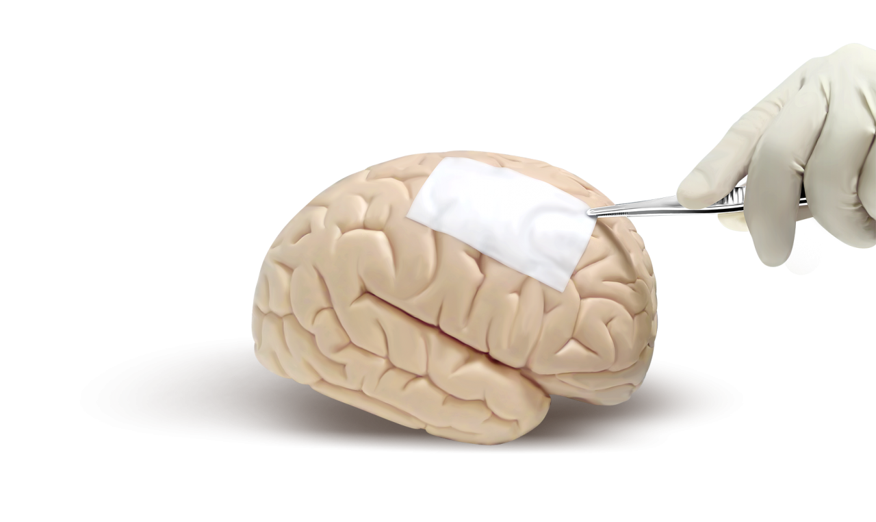 Regenerative Dural Repair Patch (Redura) - Lysithea Medical Suppliers